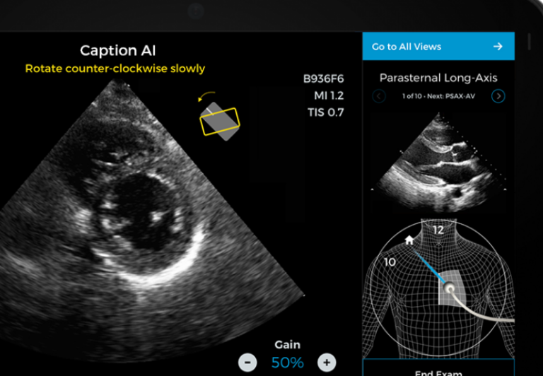 Caption Health Secures $53 Million to Commercialize AI-Guided ...