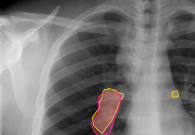 Centaur Labs Raises $15 Million for Medical Data Labeling - Mercom ...